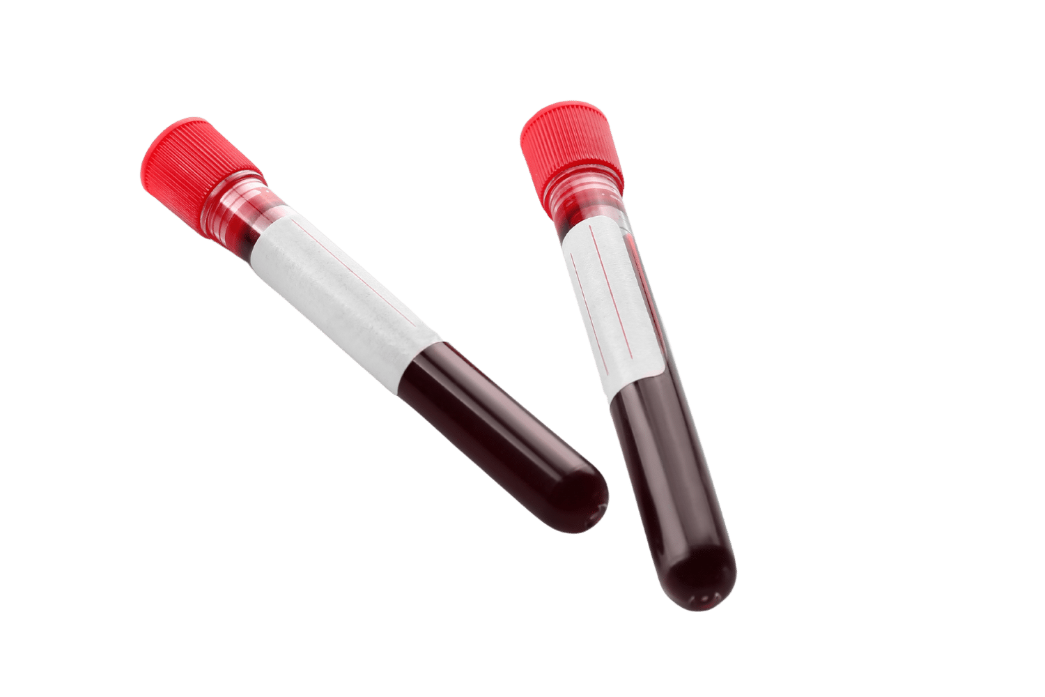 Will Ketamine Show Up On A Drug Test? Hair, Urine, & Blood Analysis ...