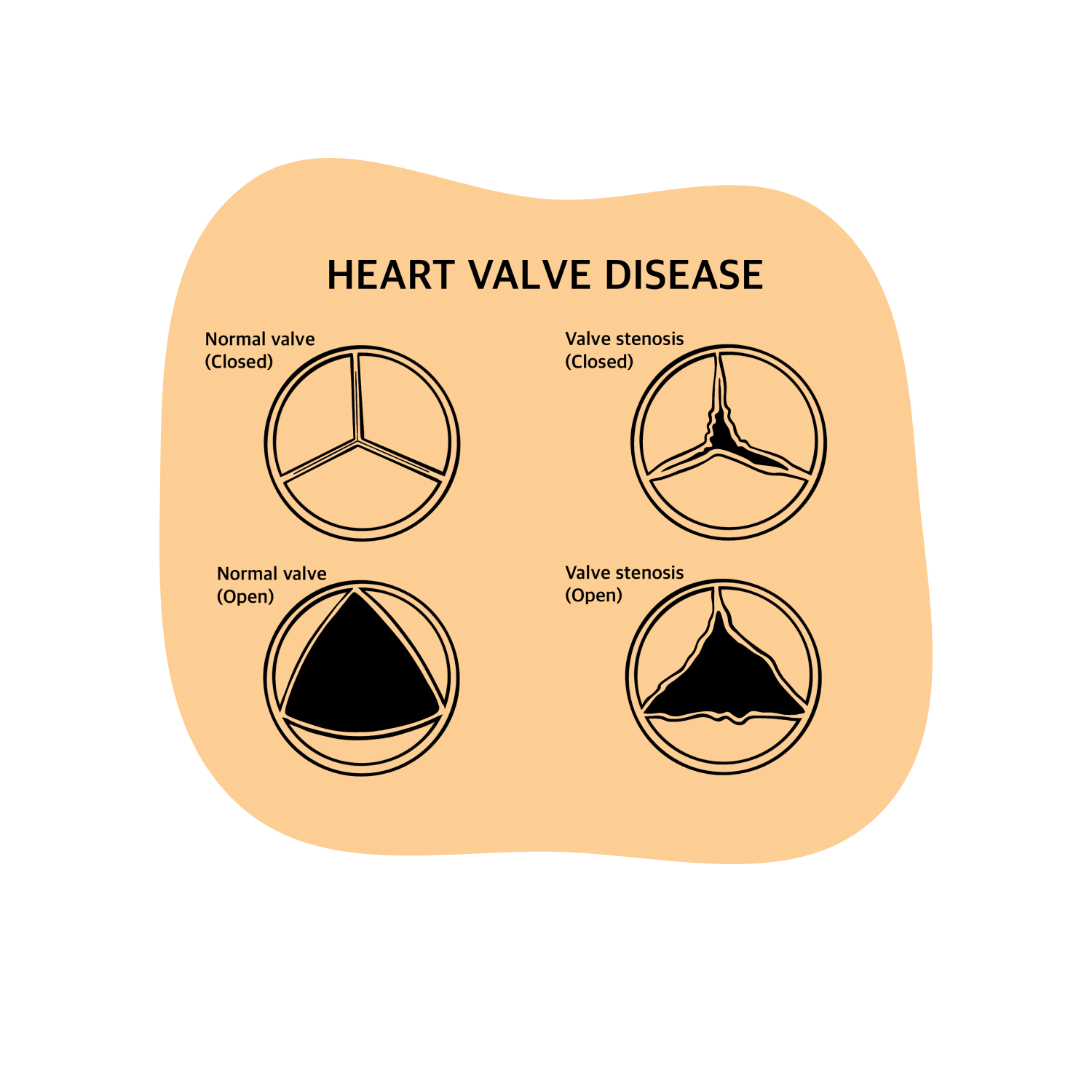 Can Psychedelics Increase the Risk of Heart Disease? - Tripsitter